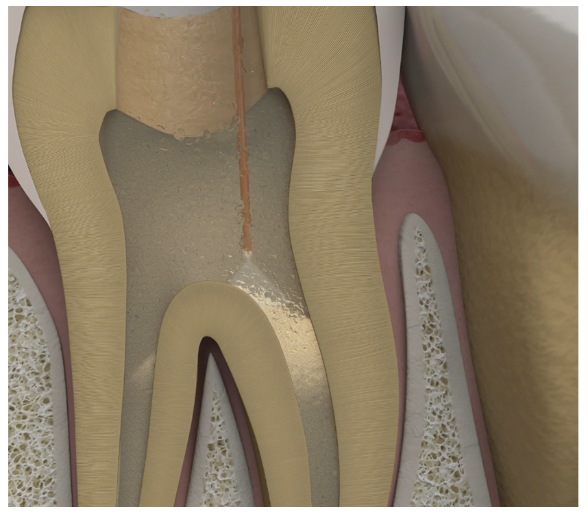Advanced Technology - Integrated Endodontics